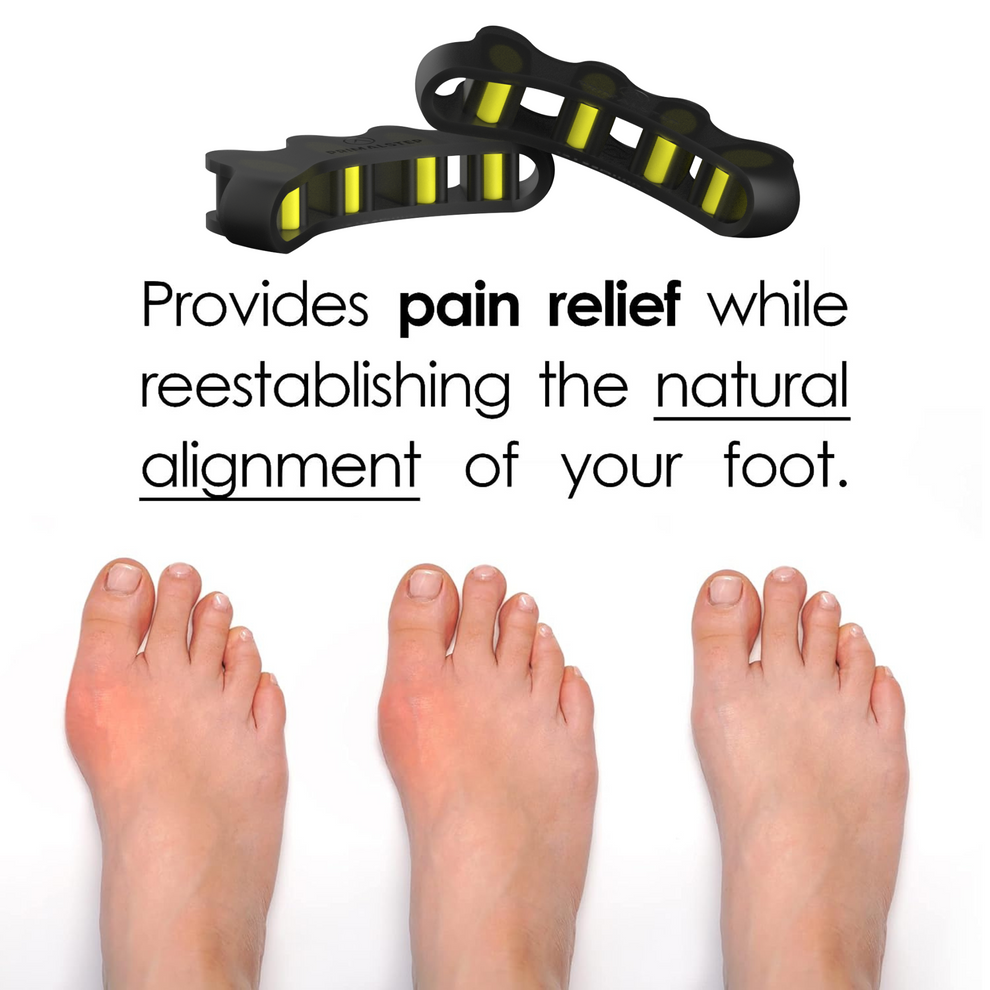 PrimalStep Fully Adjustable Toe Separators - 4 pack
